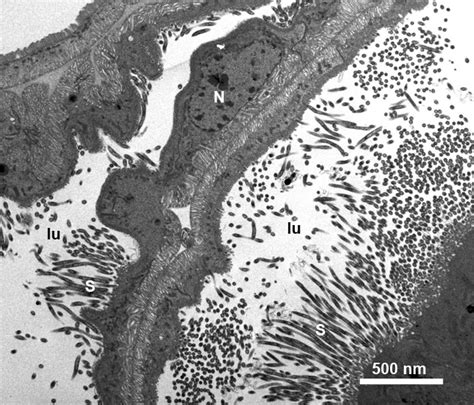 Cil12646 Insect Host Dalbulus Elimatus Hemiptera Cicadellidae