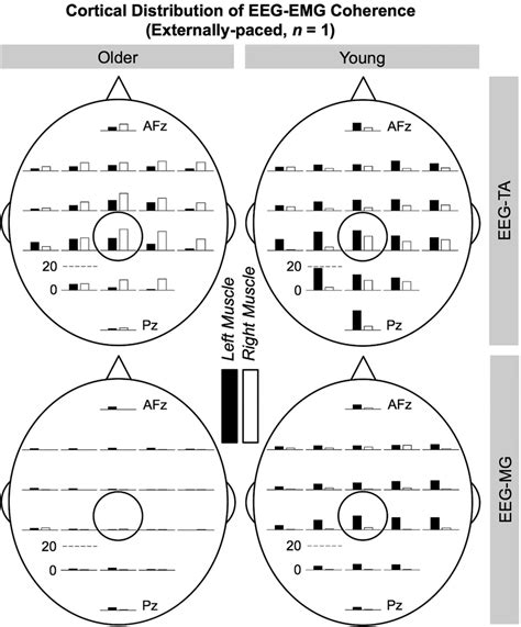 cortical distributions of significant coherence between eeg signals and