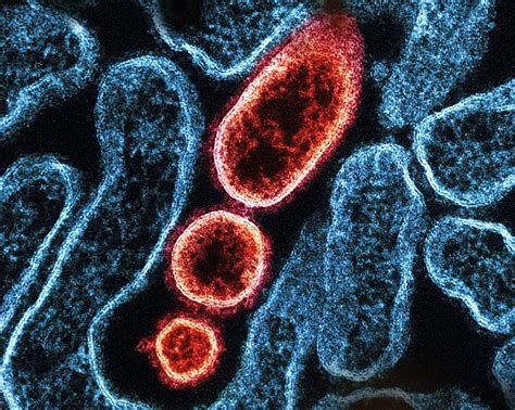 Developing A Bivalent Vaccine For Nipah Virus And A Companion Diva Rapid Lateral Flow Test