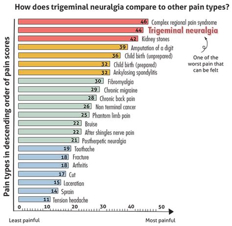 Trigeminal Neuralgia Singapore Treatment Guide 2025