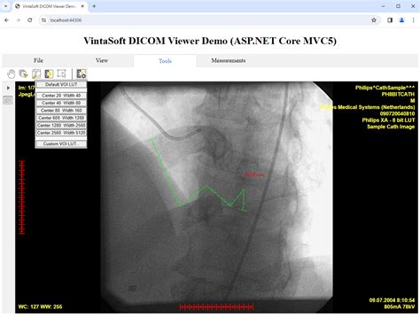 Add Web Dicom Viewer To An Aspnet Mvc5 Application