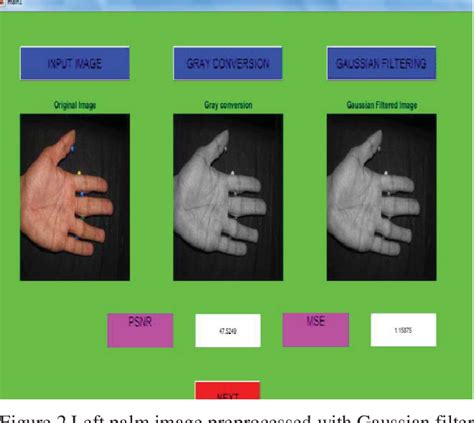 Figure 2 From Segmentation Of Palm Print By Fusion Of Algorithms And Comparison Of Mean Values