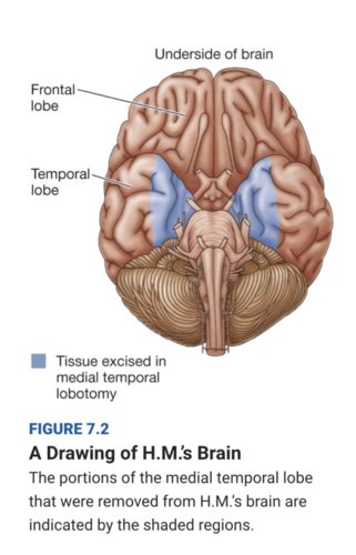Chapter Memory Flashcards Quizlet