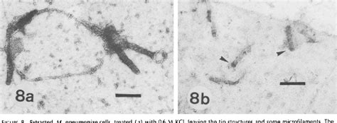 Figure 1 From Filamentous Structures In Adherent Mycoplasma Pneumoniae