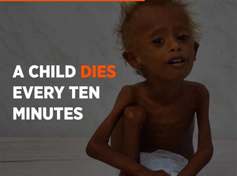 Malnutrition In Yemen