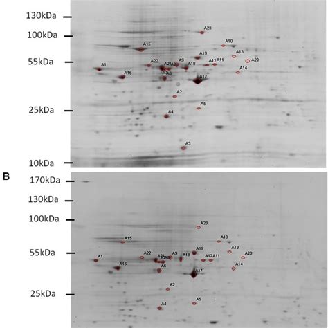 String Analysis Of Protein Protein Interactions Between Differentially