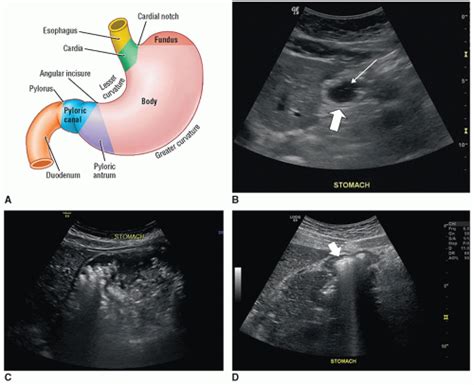 The Gastrointestinal Tract Radiology Key