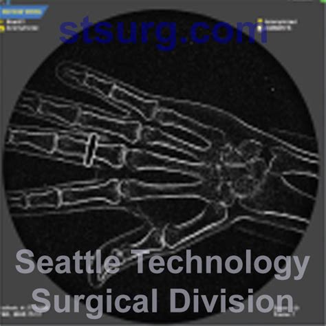 What Is Edge Enhancement In Radiography At Mary Aplin Blog