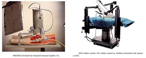 Cmr Surgical Deploys Its Surgical Robotic System Versius Nanalyze