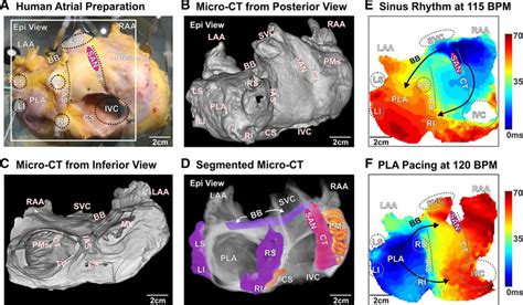 Optical Mapping Heart At Mary Benally Blog