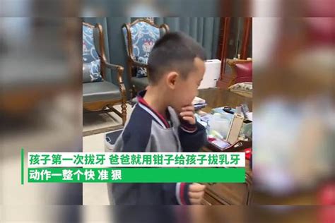 快准狠！爸爸用钳子给孩子拔乳牙网友：别说他了，我都没反应过来
