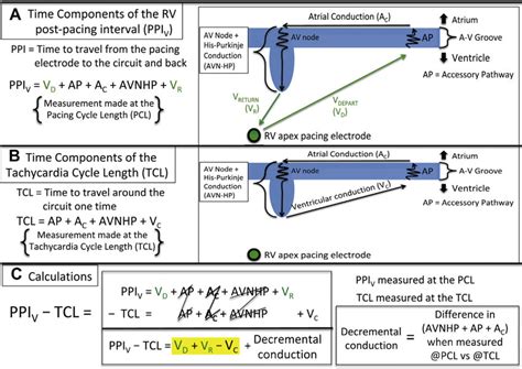 Calculating The Postpacing Interval Minus Tachycardia Cycle Length Download Scientific Diagram