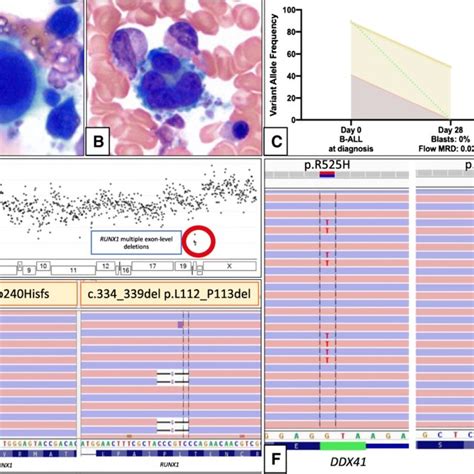 A B Carriers Of Familial Predisposition Syndrome With Germline Runx1 Download Scientific