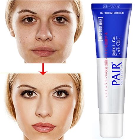 Japan Pair Anti Acne Cream G Pimple Marks Remover Face Acne Pimple Treatment Skin Repair