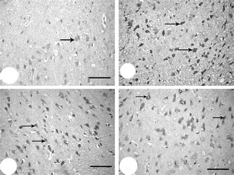 A A Photomicrograph Of A Section Of Left Frontal Cerebral Cortex From