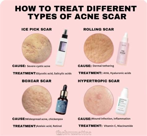 Skin Treatments For Acne Acne Scar Skincare Routine Acne Scar Skin