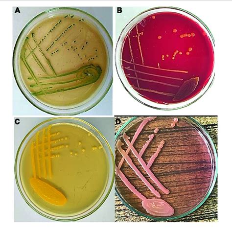 Morphological Appearance Of Cronobacter Sakazakii Colonies Samples