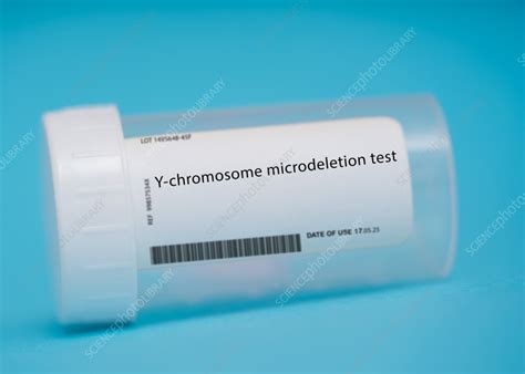 Y Chromosome Microdeletion Test Stock Image F042 0418 Science Photo Library