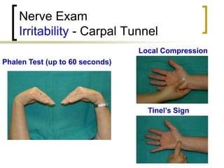 Carpal Tunnel Syndrome Pptx