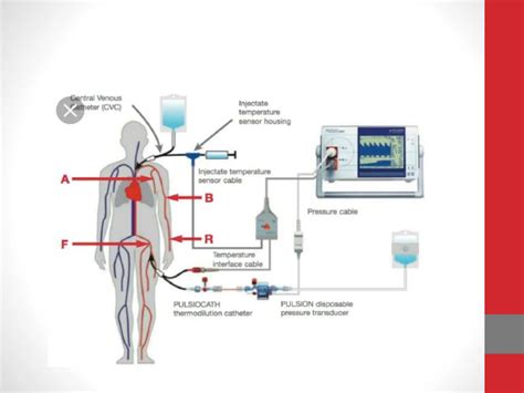 Cardiac Output Measurment And Monitoring Ppt Pptx