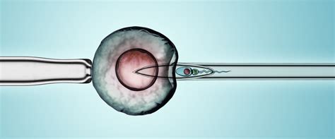 Intracytoplasmic Sperm Injection Icsi Bdms Wellness Clinic