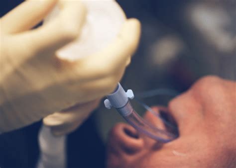 Methods Of Intubation In Obese Patients Hospital Procedures Consultants