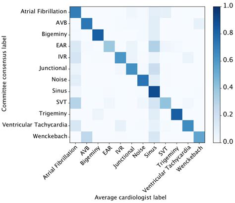 Cardiologist Level Arrhythmia Detection And Classification In