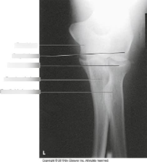 Ap Proximal Forearm Ch 5 Diagram Quizlet