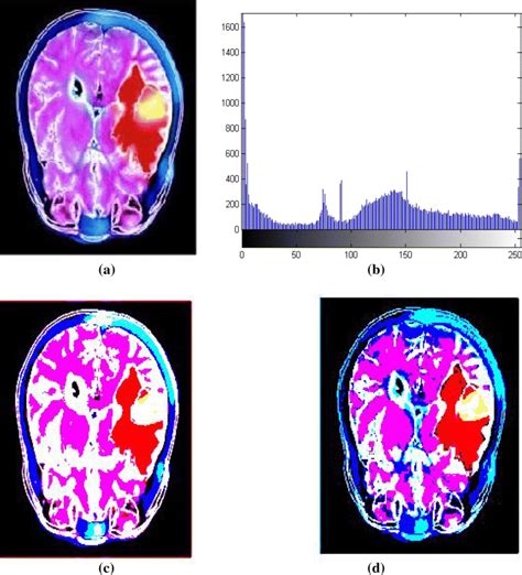 Segmentation Of Image 2 A Original Image B Histogram C Segmented Download Scientific Diagram
