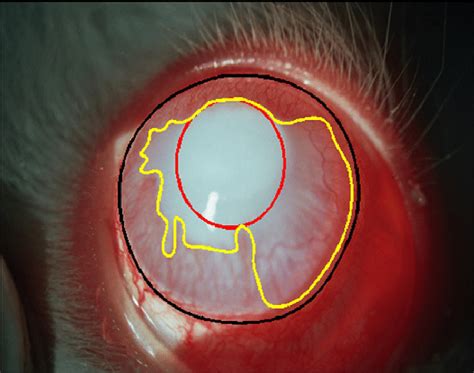 Corneal Neovascularization Areas Were Calculated On Photographs Using