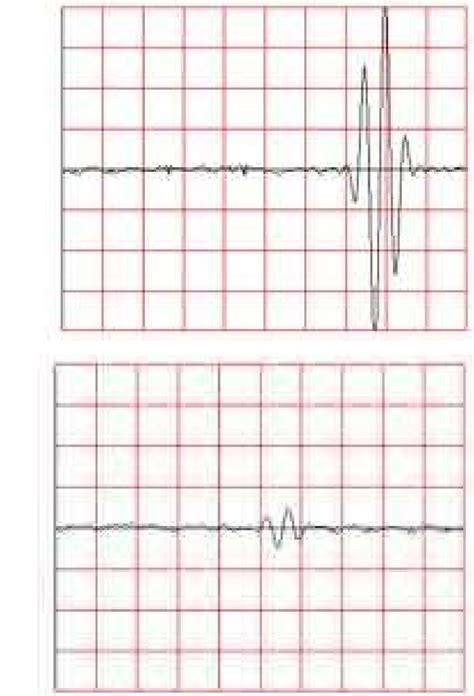 Figure 29 Understanding Ultrasonic Testing Of Steel