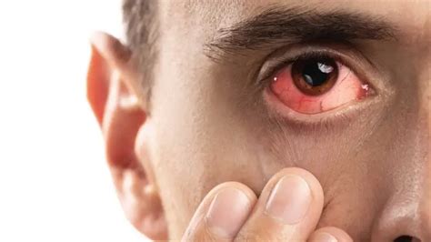 Is Your Eye Infected 10 Key Signs To Watch For