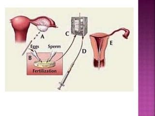 REPRODUCTIVE HEALTH PROBLEMS AND STRATEGIES Pptx