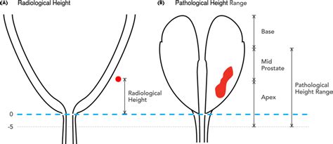 Radiological Height And Pathological Height Range Calculations Download Scientific Diagram