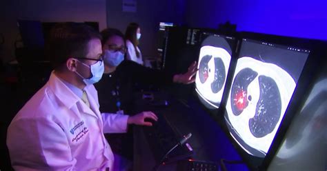 Ai Could Revolutionize Cancer Detection According To Mit Mass General