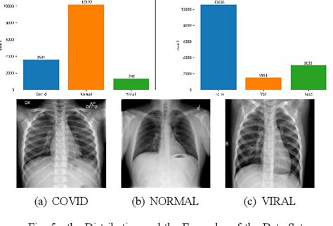 Figure 1 From An Enhanced Convolution Neural Network Model Based On Depthwise Separable