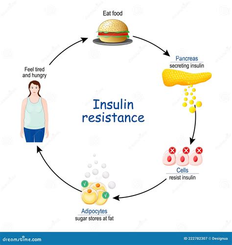 Insulin Resistance Cycle Of Insulin And Glucose Cartoon Vector