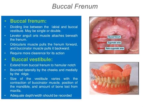 Maxillary And Mandibular Anatomical Land Marks Pptx