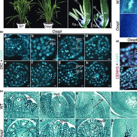 In Situ Expression Analysis Of Meiosis Arrested At Leptotene1 Mel1