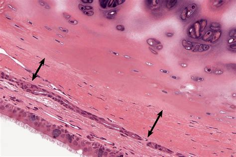 Perichondrium Histology
