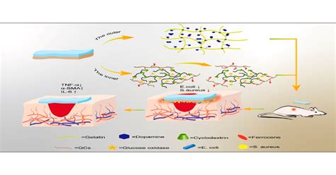 Double Layer Hydrogel With Glucose Activated Two Stage Ros Regulating