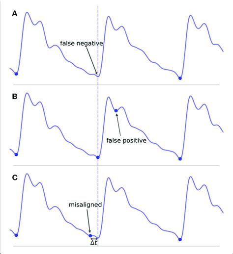 Shown Are The Different Types Of Classification Errors These Are Shown Are The Different Types Of Classification Errors These Are
