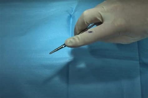 Surgery Injection Alternative To Surgery For 24 Year Old Youth Facing