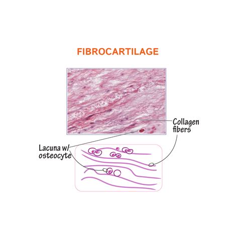 Elastic Cartilage Drawing