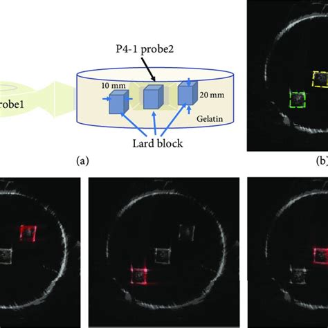 Schematic Of An Xrai And Us Dual Modality Imaging System Built On A Download Scientific Diagram