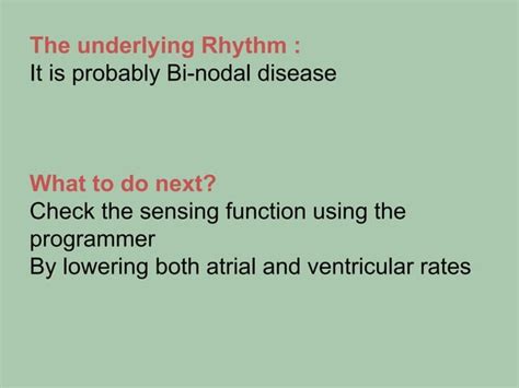 Pacemaker Ecgs Yasmeen Kamal Pptx