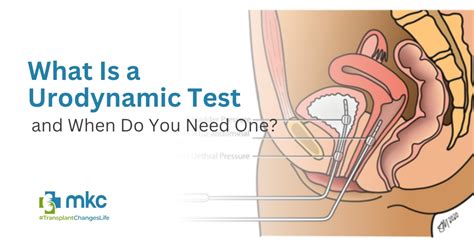 What Is A Urodynamic Test And When Do You Need One Mkc