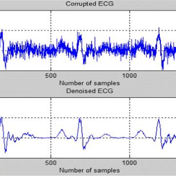 Original and denoised ECG signals using DENLMS algorithm | Download Scientific Diagram