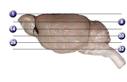 The Mouse Brain Library