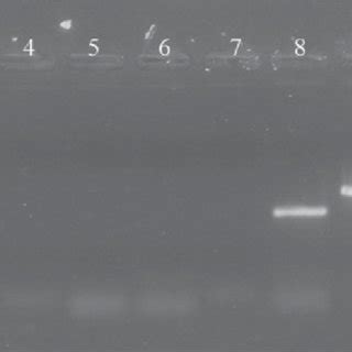 Examples Of Multiplex PCR Results Obtained Using Target DNA Of Typed